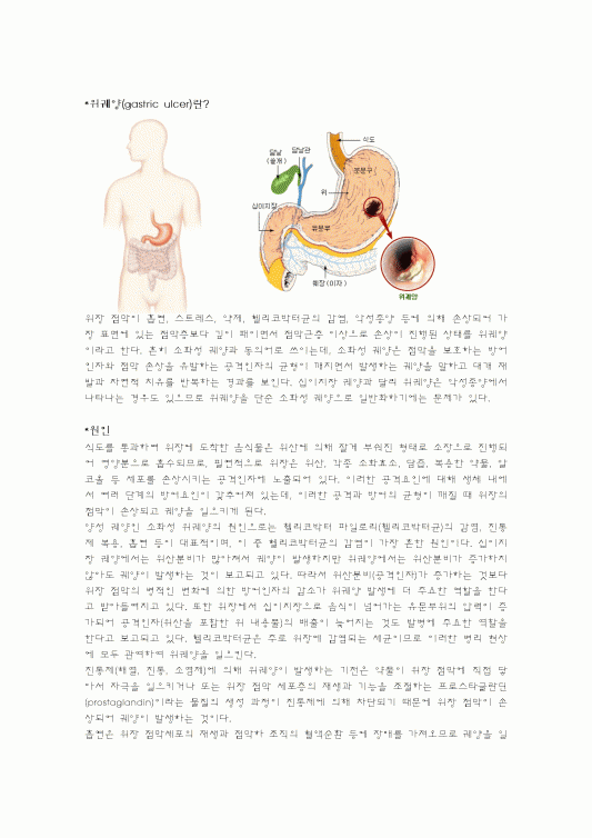 위궤양(gastric ulcer) 케이스