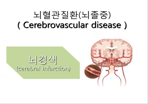 당뇨병과 당뇨합병증, 급성합병증, 만성합병증, 합병증관리 및 치료20130603 (1)