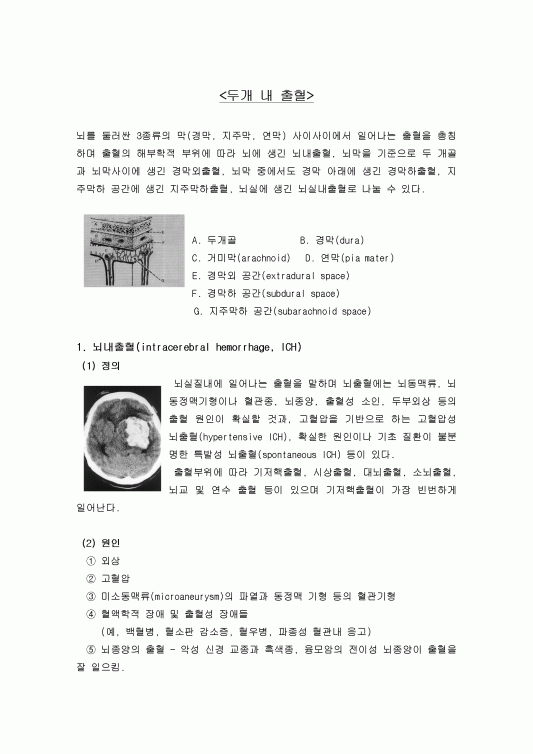 [의학] 두개 내 출혈에 관해