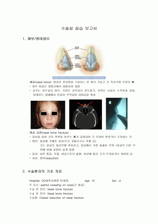 수술실(OR) 실습보고서 - 비골 골절(nasal bone fracture)