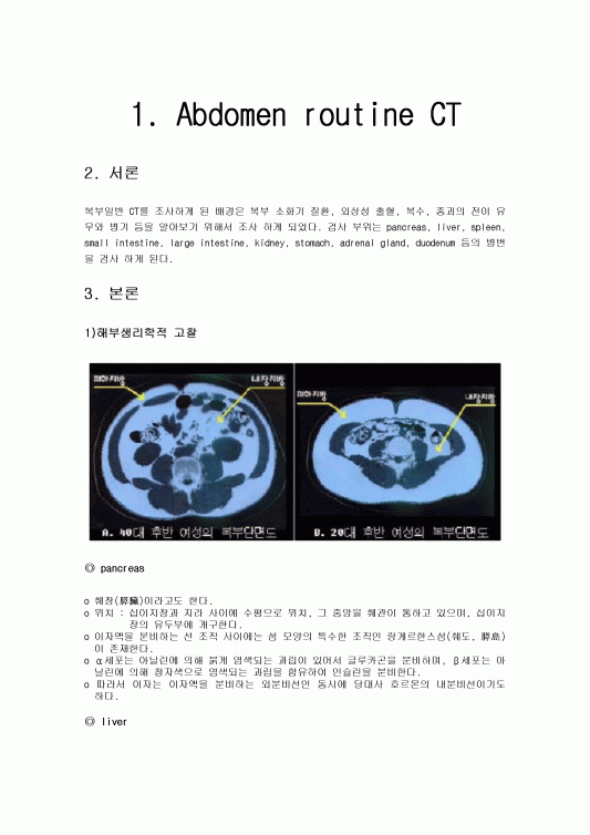 복부 CT 검사 레포트 자료