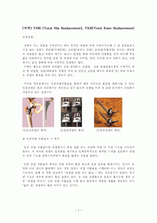 [의학] 고관절 전치술, 슬관절 전치술 -THR [Total Hip Replacement], TKR[Total Knee Replacement]