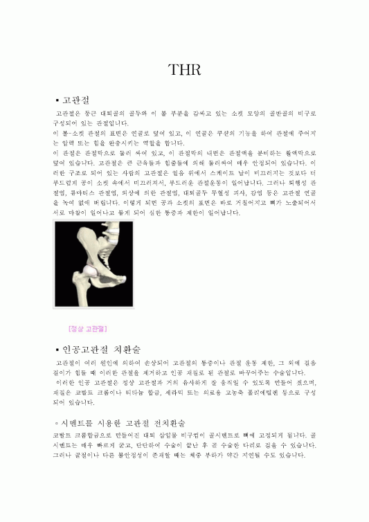 [의학] 고관절인공관절전치환술[Total Hip Replacement]에 관해