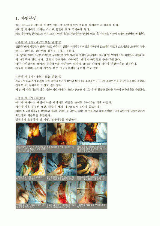 [모성] 분만 종류 (자연분만,수중분만,무통분만,경막외마취,유도분만,제왕절개,흡인분만과 겸자분만,라마즈,소프롤로지분만,그네분만,아로마분만,르봐이예,좌식,경락,공분만,가정분만,듀라분만,기둥분만 등)