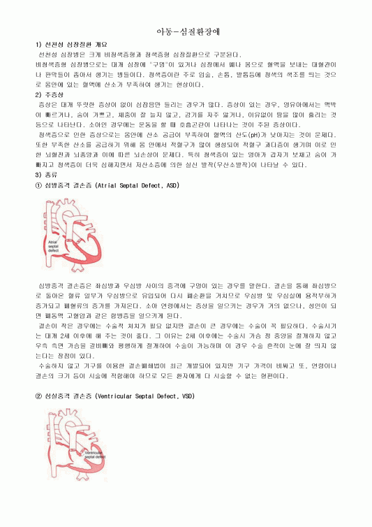 아동심장질환