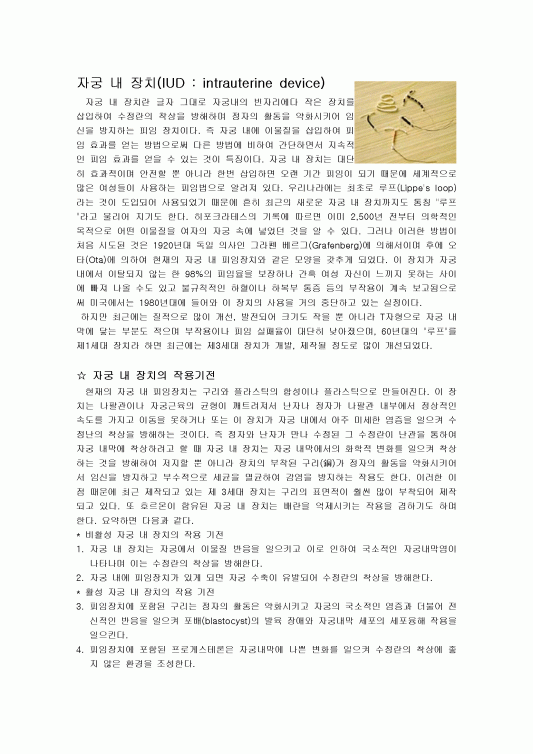 피임법 중 IUD 레포트 자료