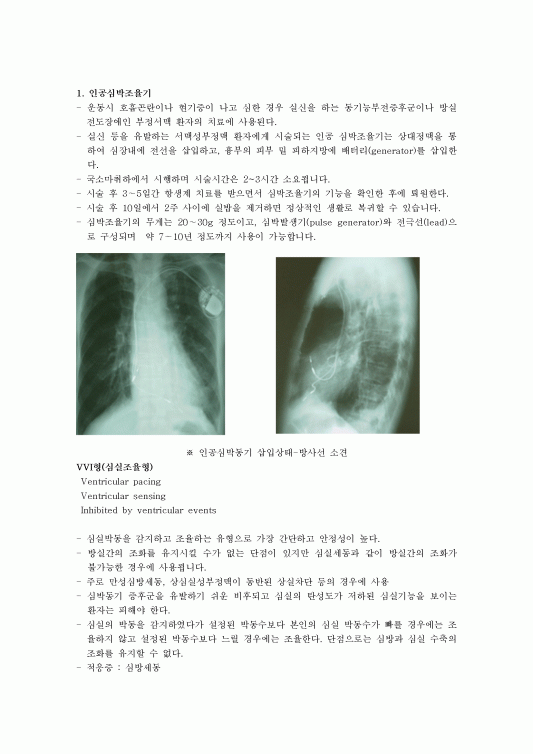 인공심박조율기 (pacemaker)