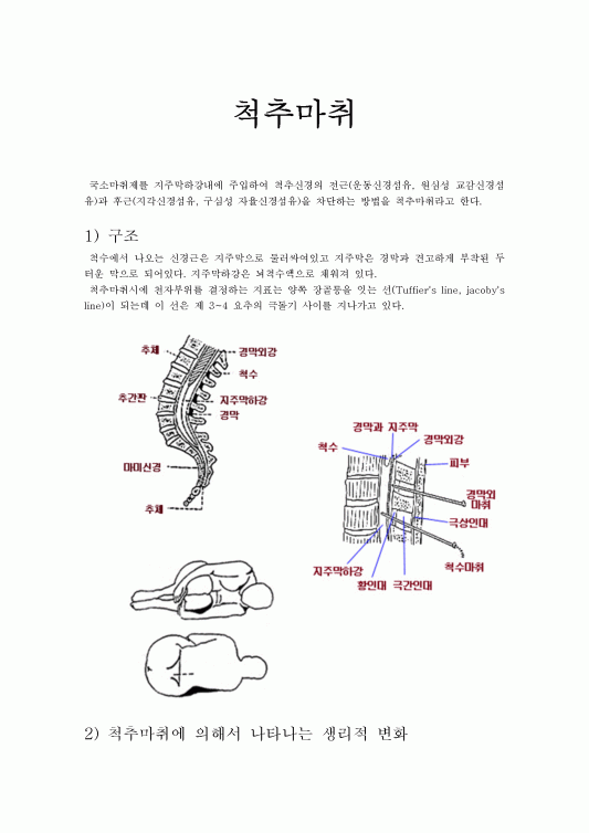 척추마취의 특성과 합병증