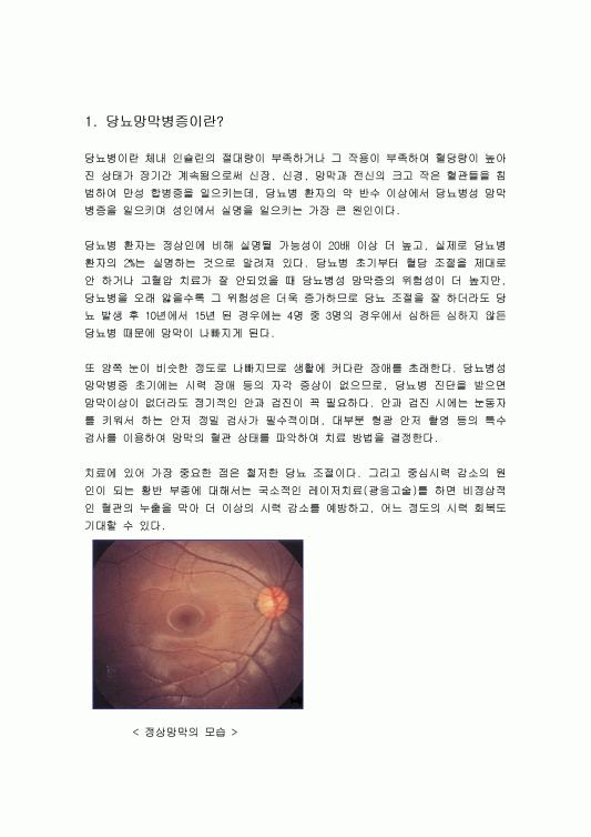 당뇨망막병증