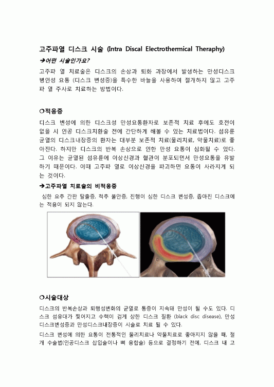 [의학] 고주파열 디스크 시술 (Intra Discal Electrothermical Theraphy)