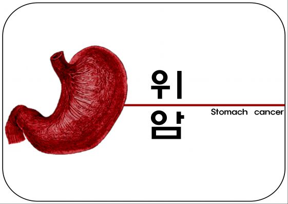 위암 발표 PPT 자료 !