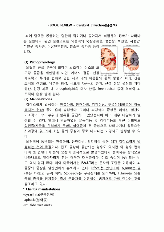 Cerebral Infarction(뇌경색) 문헌고찰
