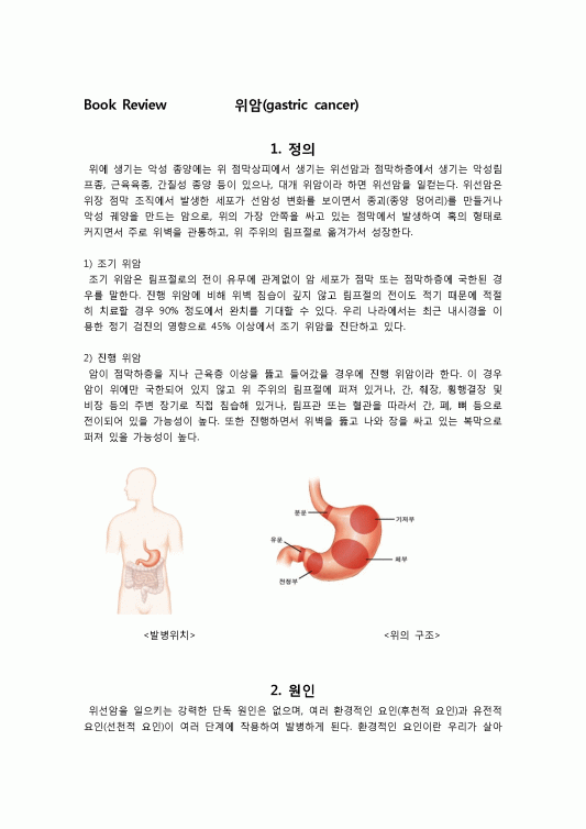 위암 문헌고찰(gastric cancer)