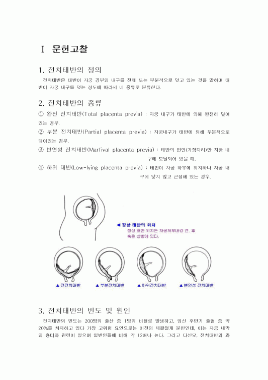 여성, 모성간호학 실습- 전치태반 case study 컨퍼런스