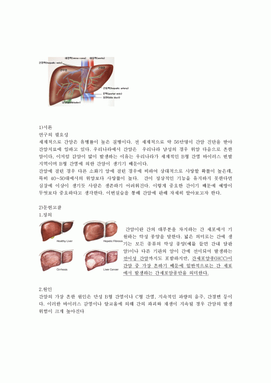 간암 case study / 성인간호학 실습 간암 컨퍼런스