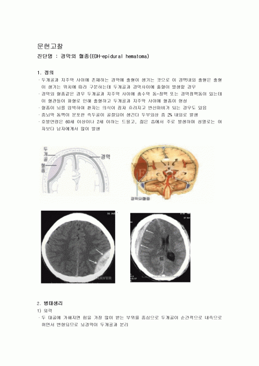 경막외혈종케이스(문헌고찰부터~간호진단까지)