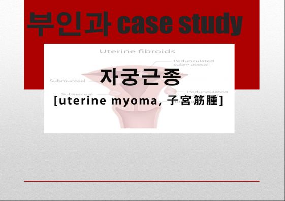 자궁근종 케이스 스터디 받았어요