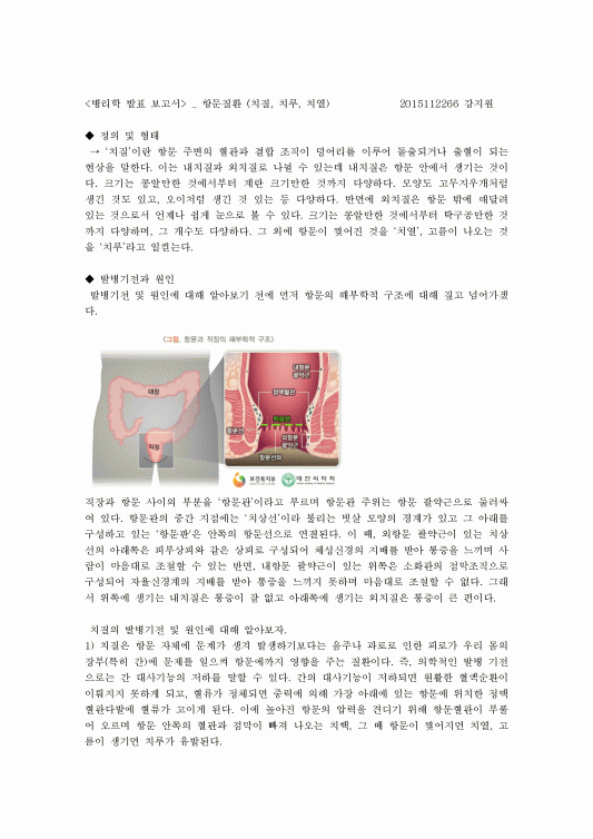치질,치루,치열