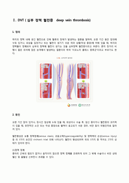 DVT , 심부정맥혈전증