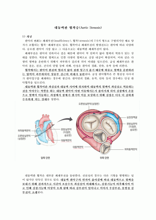 [성인간호] 대동맥판 협착증(Aorta stenosis) 병태생리