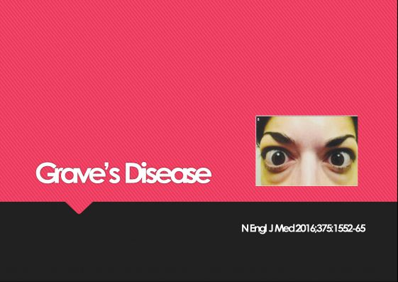 Graves disease (그레이브스 병, 갑상선 항진증)