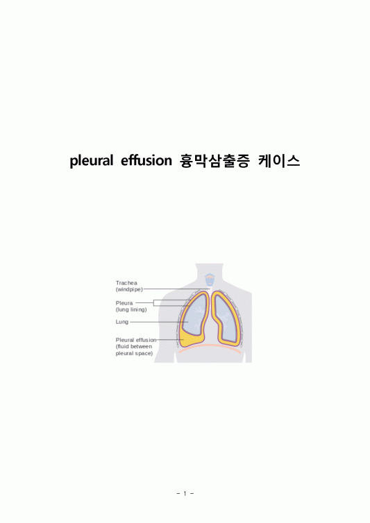 pleural effusion 흉막삼출증 케이스, 흉수 케이스, 흉막삼출증 간호과정, pleural effusion 케이스, 흉막삼출증 사례연구