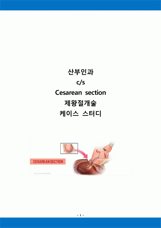c/s case (cesarean section 케이스 제왕절개술 케이스 스터디, cesarean section case, 제왕절개술 간호과정, 제왕절개술 사례연구)