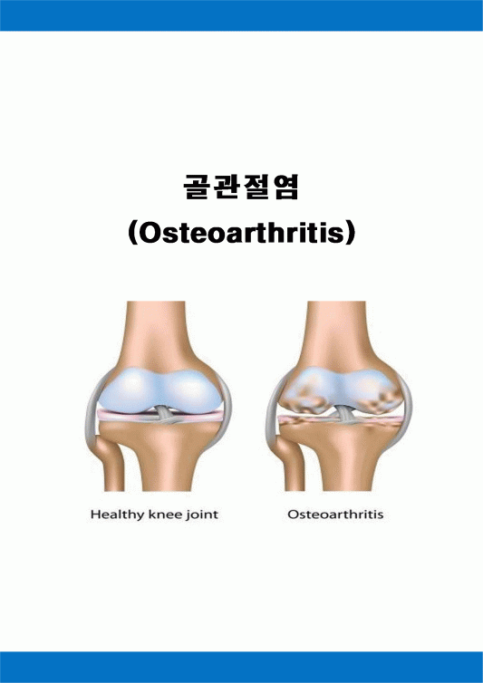 골관절염 (Osteoarthritis) TKR - # Osteoarthritis 케이스, 골관절염 케이스, 골관절염 간호과정, TKR 간호과정, TKR 수술, TKR 케이스 스터디, Osteoarthritis 간호과정)