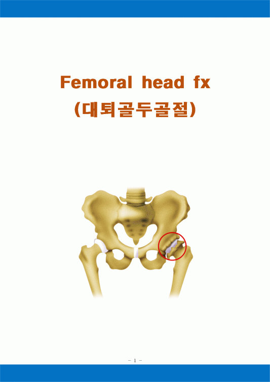 대퇴골두골절 Femoral head fx 케이스 스터디