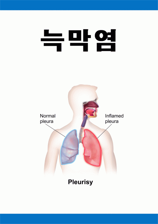 늑막염 케이스 스터디
