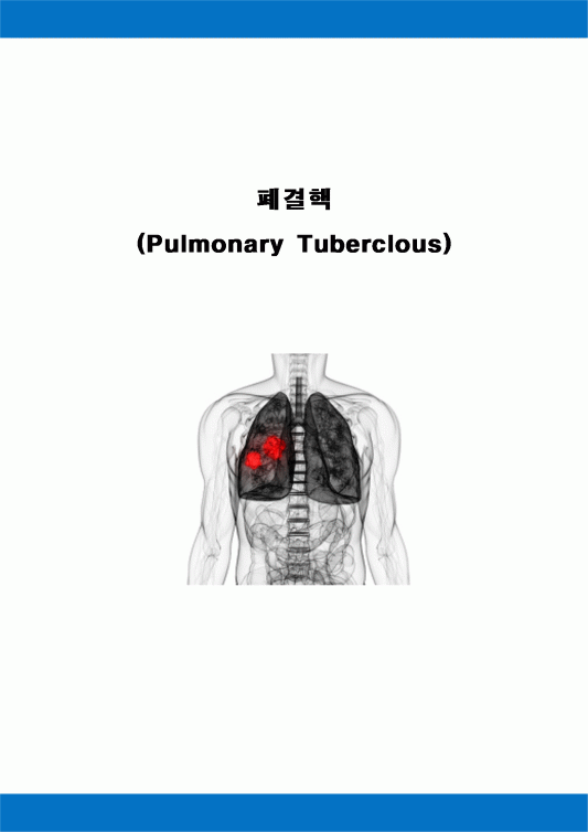 폐결핵 케이스 스터디