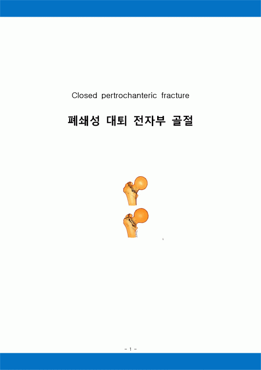 Closed pertrochanteric fracture 폐쇄성 대퇴 전자부 골절 (폐쇄성 대퇴 전자부 골절 케이스 , 폐쇄성 골절 케이스, Closed pertrochanteric fracture CASE Study, 폐쇄성 대퇴 골절 케이스, 대퇴골절 간호과정