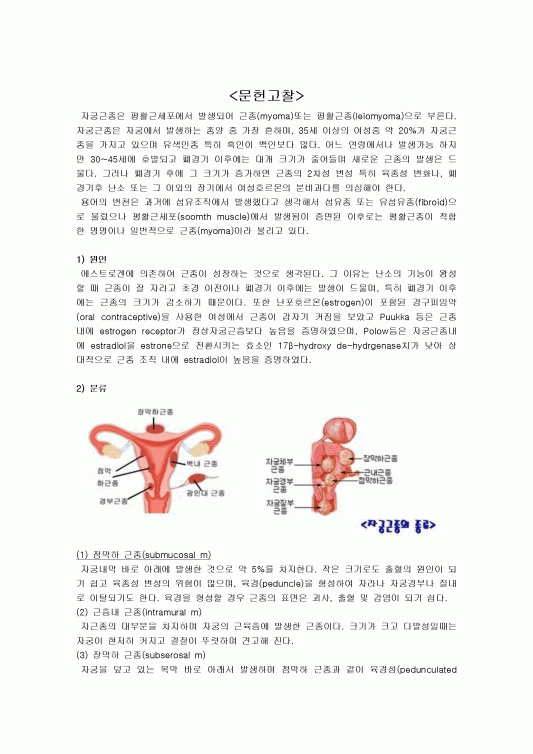 myoma(자궁근종) 케이스