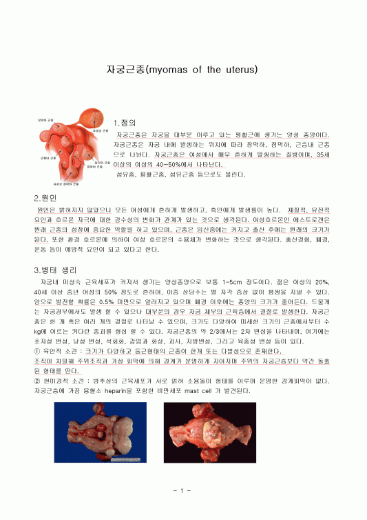 모성 자궁근종