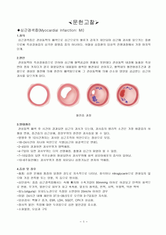 성인 MI 레포트 자료