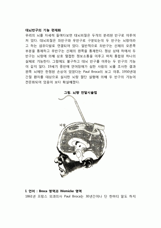 대뇌반구의 기능 편재화
