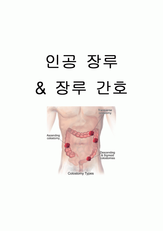 인공 장루와 장루 간호