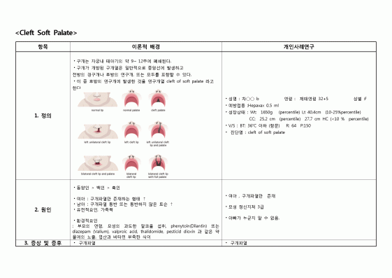 소아과 case study (연구개열) (간호사정, 진단, 계획, 목표, 지시, 근거, 수행, 평가, 예후, 관리 다 포함)