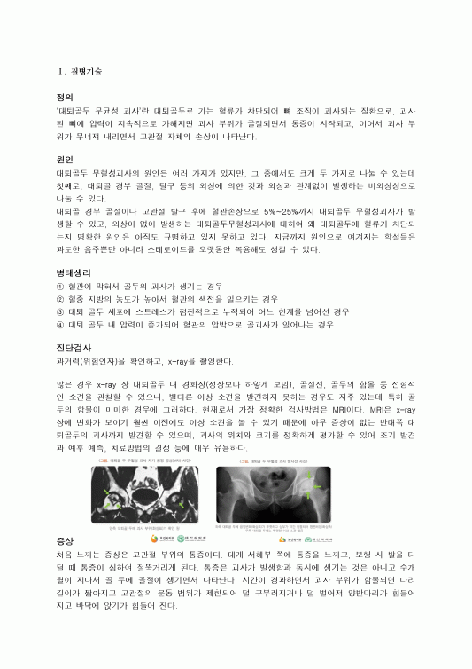 성인간호학 대퇴골두무혈성괴사 case