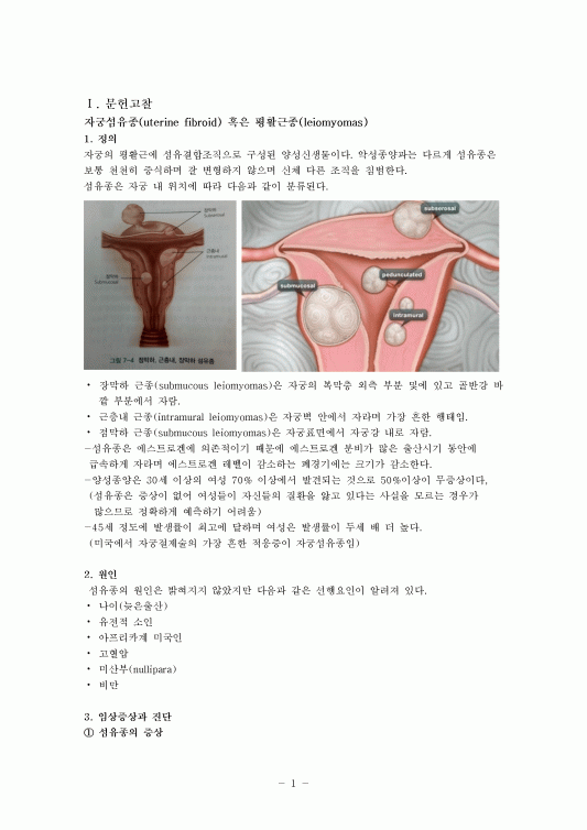 간호학 자궁근종 케이스(모성간호학성인간호학케이스스터디