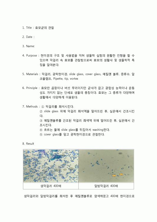 [일반생물학 실험] 효모 현미경 관찰 결과-생막걸리 시판막걸리 사용