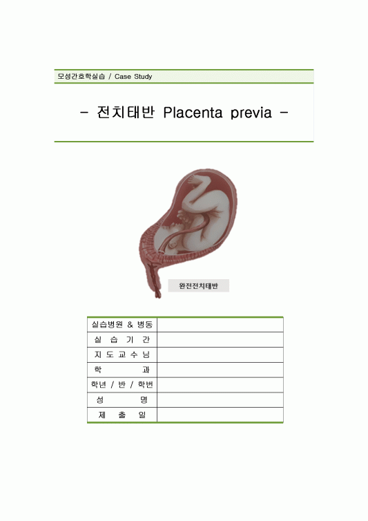 전치태반 간호과정