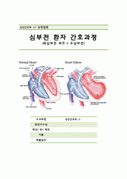 성인간호학 심부전 간호과정