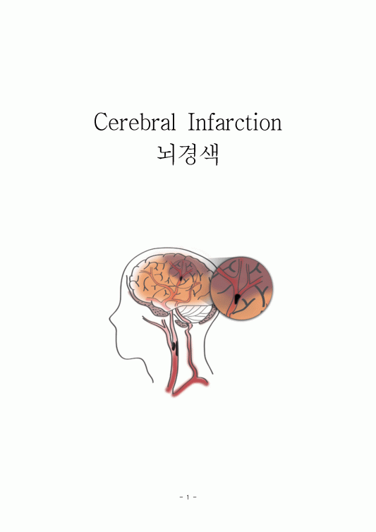 뇌경색 cerebral infarction