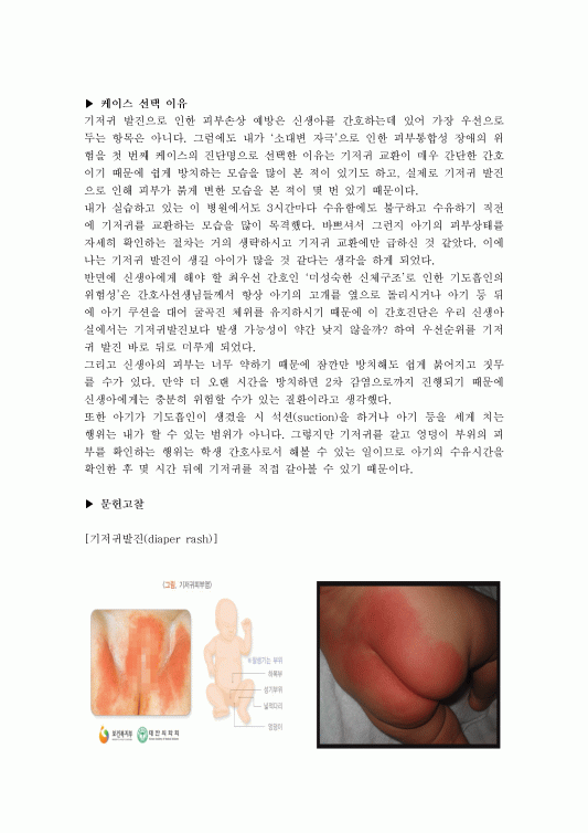 기저귀발진에 대한 문헌고찰 및 간호과정