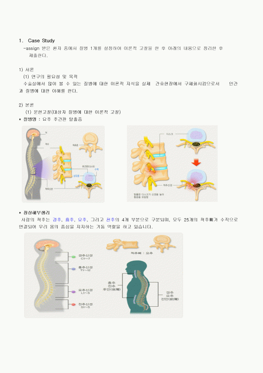 요추 추간판 탈출증 (수술실 실습 레포트)