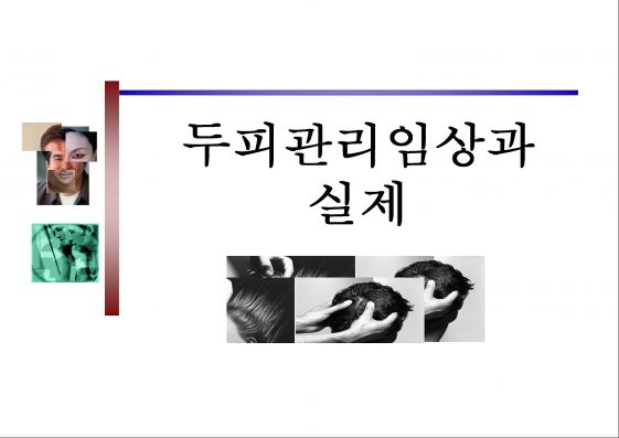 두피관리 임상과 실제