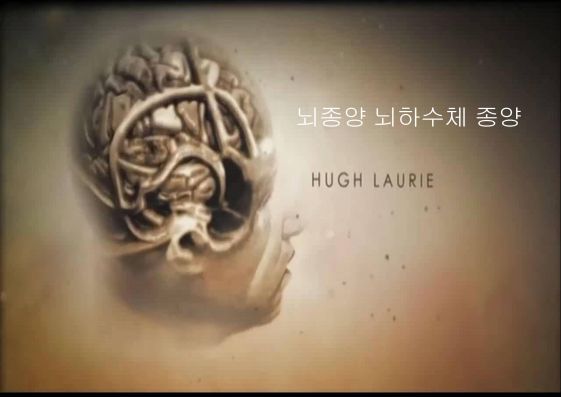 칭찬받은 과제 신경계 뇌종양 뇌하수체 종양 수술간호 ppt 프레젠테이션 신경계란? / 뇌 / 뇌하수체 /뇌종양 /뇌하수체 종양 및 증상/경접형동 접근법 TSA/수술 과정/수술 전,후 간호/합병증 (해외논문)/합병증 예방 간호/퇴원 교육