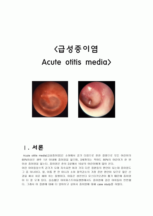 급성중이염 케이스,급성중이염case, 중이염 case, 아동간호학