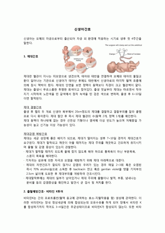 신생아 간호 (제대간호, 출혈예방간호,보육기, 방사보온기, 신생아 광선치료)